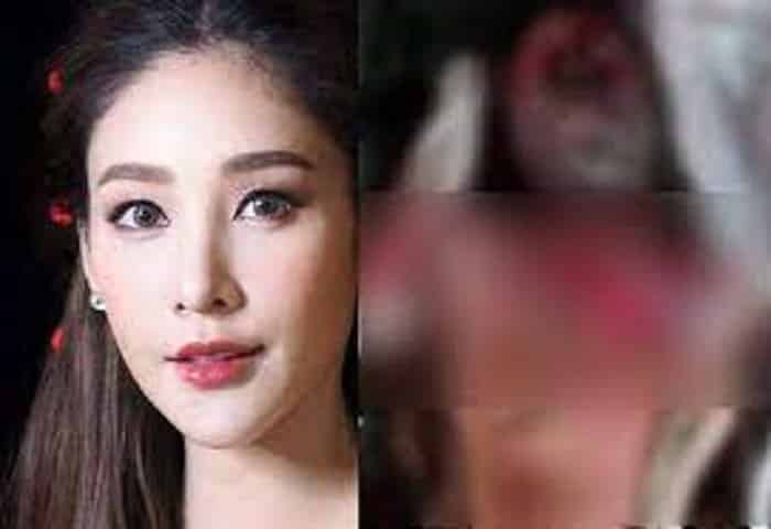 Bedah siasat kedua dapati luka di paha kanan Tangmo Nida terjadi sebelum kematian